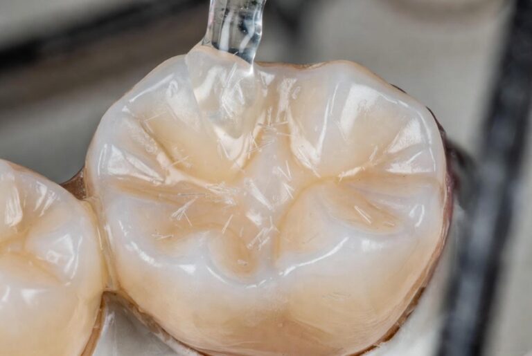 Enamel Regeneration Gels: Hype or Real Breakthrough?